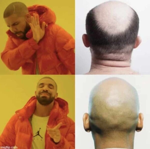 Bald Memes: 30 Memes Appreciating the Bald Fellas