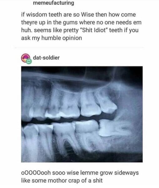 Dental Memes: 30 Hilarious Memes About the Dentist
