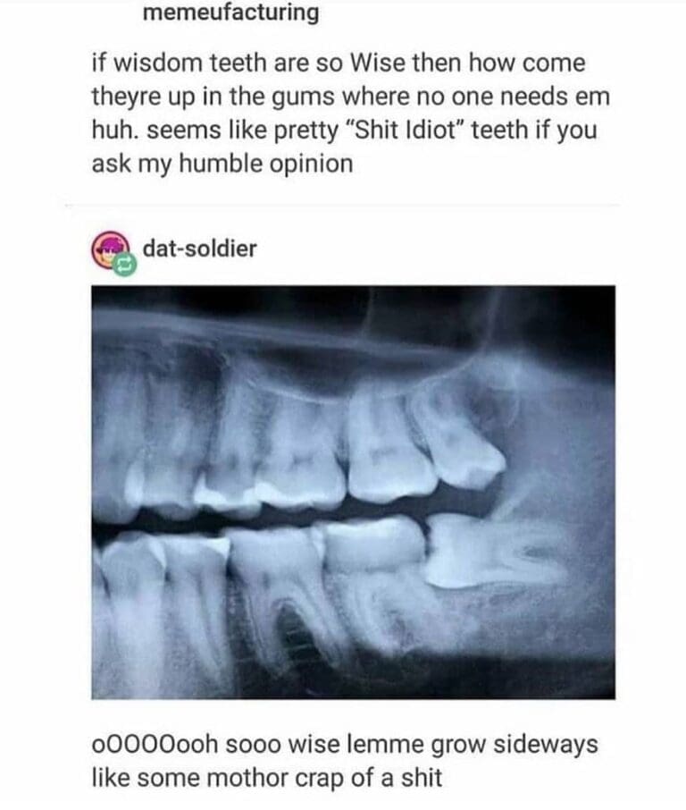 Dental Memes: 30 Hilarious Memes About the Dentist