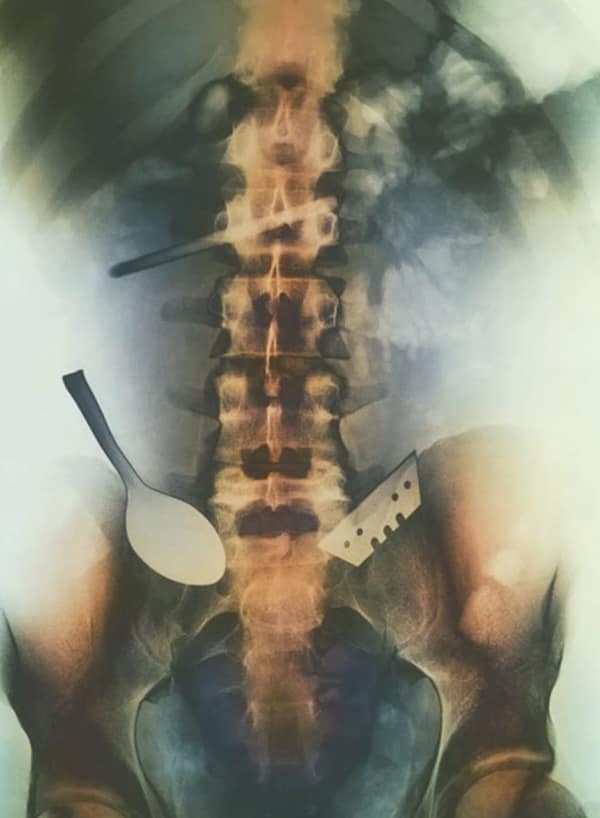 31 Weird X-Ray Photos That (Yes) They Really Are Real