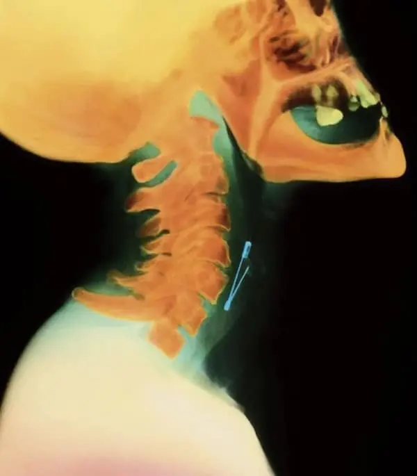 31 Weird X-Ray Photos That (Yes) They Really Are Real